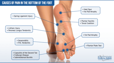 Foot Pain Chart | Metro Tulsa Foot & Ankle